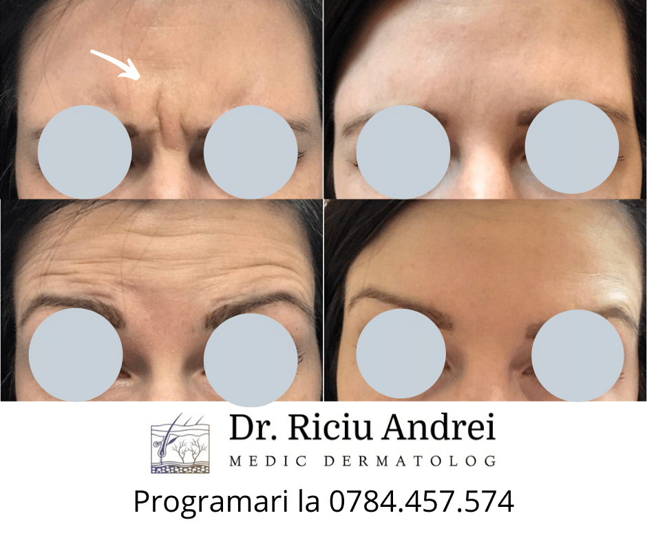 Galerie - Dr Riciu Andrei - Medic Dermatolog - Cabinet Dermatologie